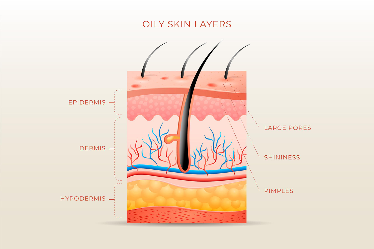 How to know oily skin and its needs? - pierrebeauty