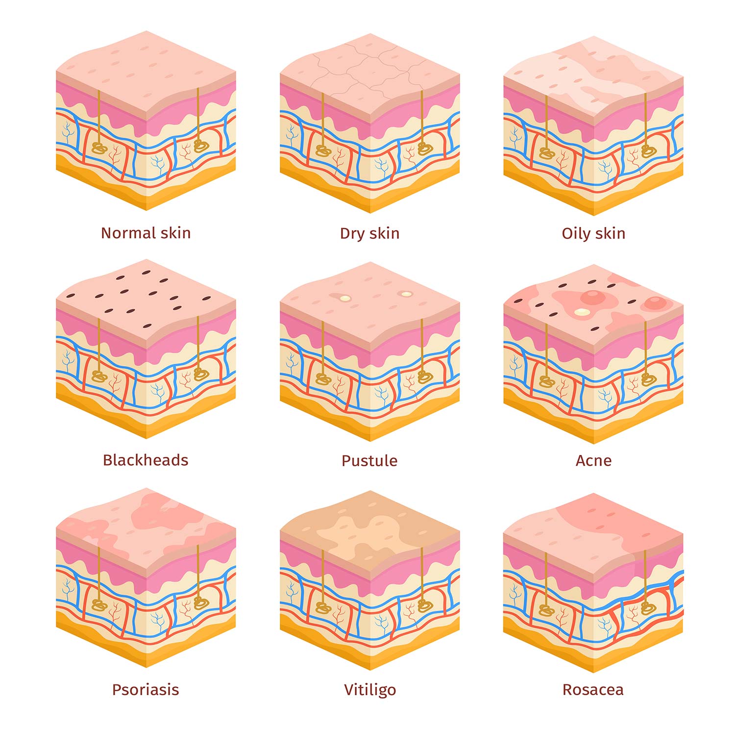 Knowing the types of skin and how to care for it - pierrebeauty